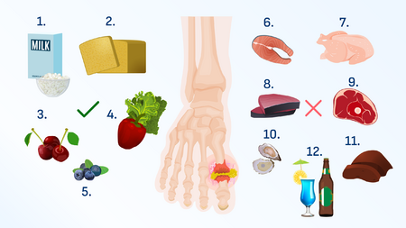 Dna - popis, léčba a doporučení lékařů